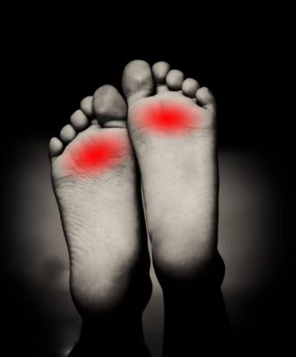 Demystifying the Medical Term for Ball of Foot: A Comprehensive Guide